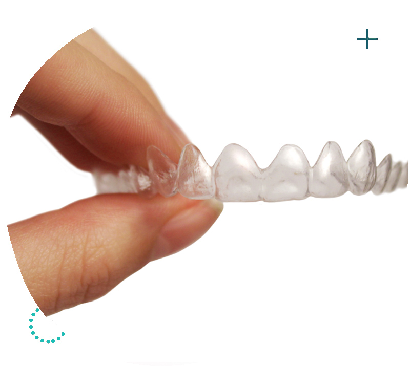 Retainers - The Braces Practice