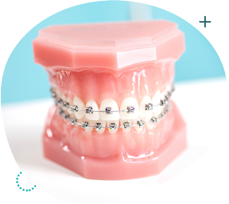 The Braces Practice: Affordable Dental Braces Treatment SG