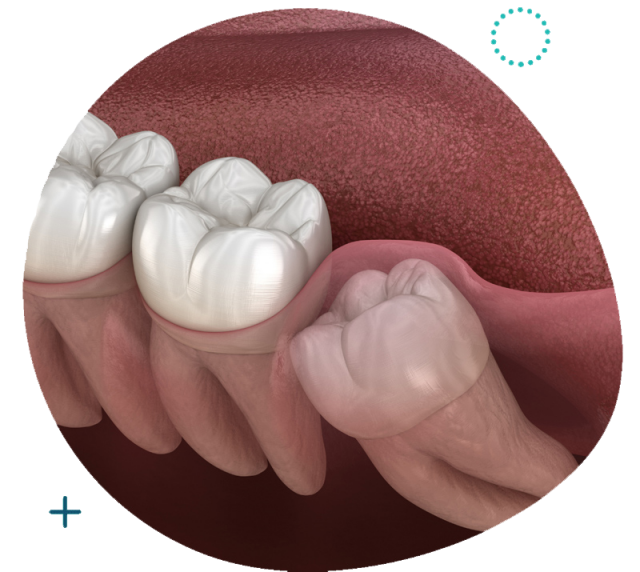 The Braces Practice: Affordable Dental Braces Treatment SG