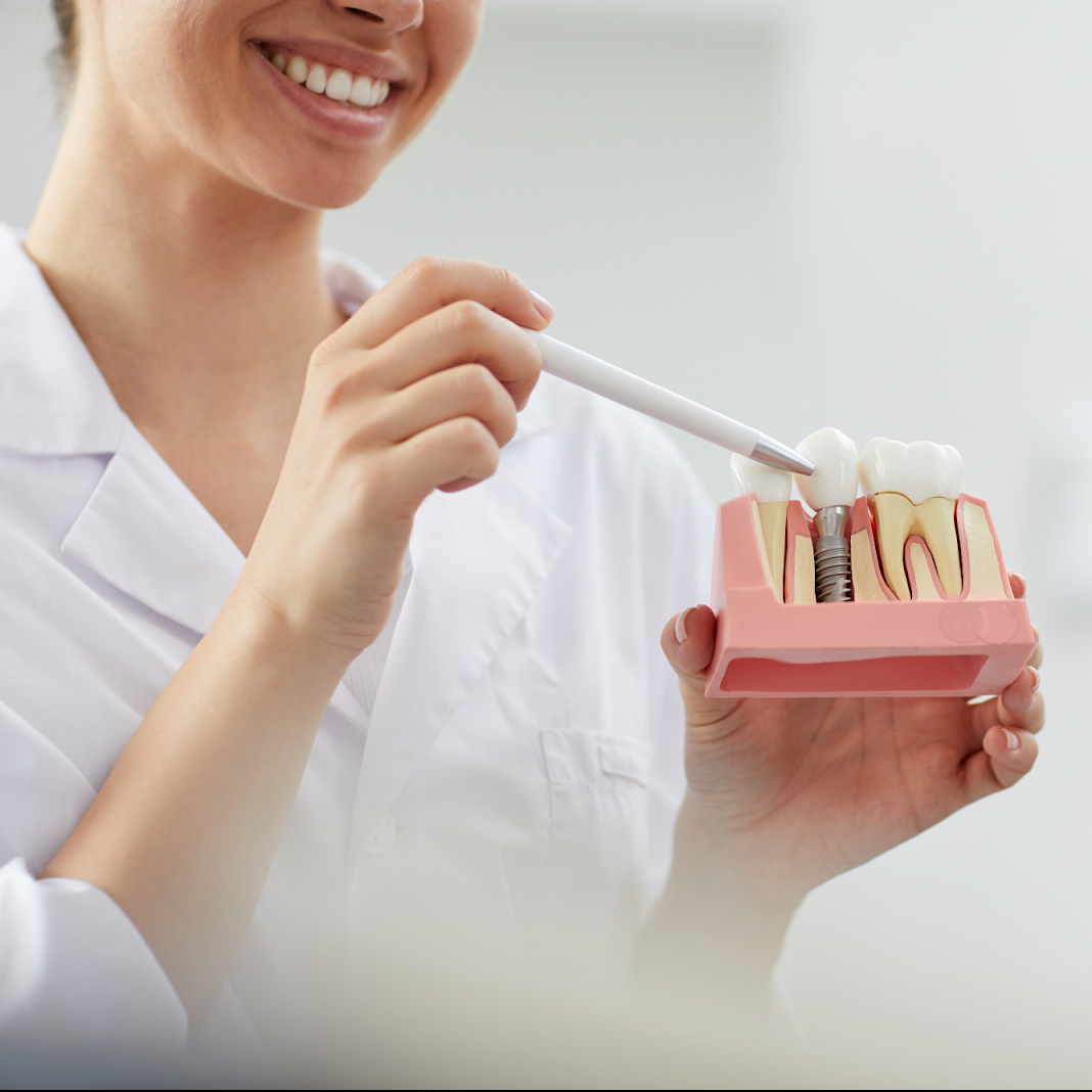 What is Dental Tooth Crown? Everything You Need To Know - The Braces ...