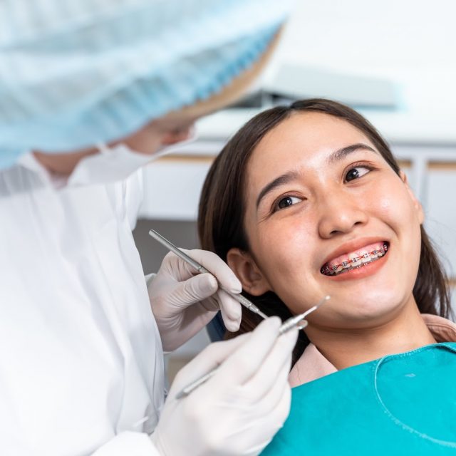 Tooth Extraction For Braces: Do You Need It? - The Braces Practice